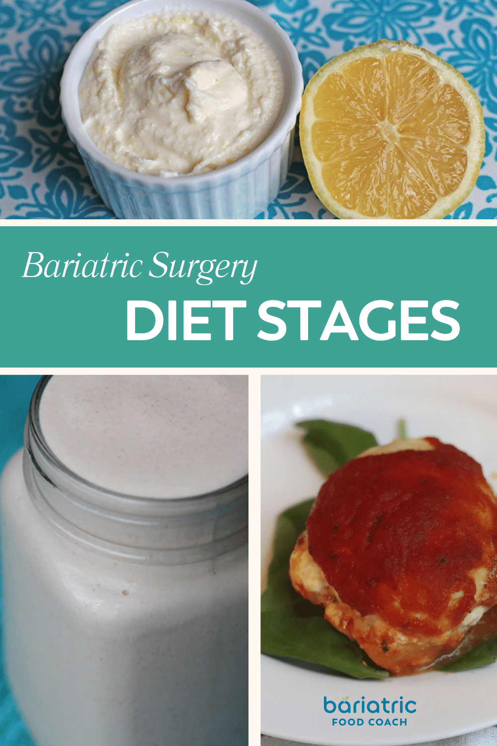 Bariatric Diet Stages | Bariatric Food Coach